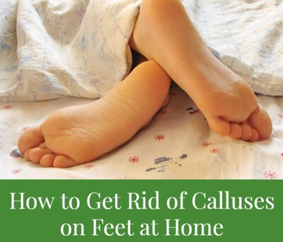 How to Get Rid of Calluses on Feet at Home - Cushy Spa